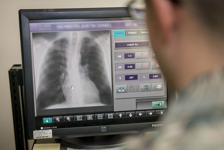 Look Up Tables in Radiography: Why Are They Useful?