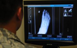 Essential Steps for Radiation Safety: What Should the X-ray Tech Do?