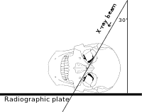 CE4RT - X-ray Positioning of the Mastoid Process for Radiologic Techs