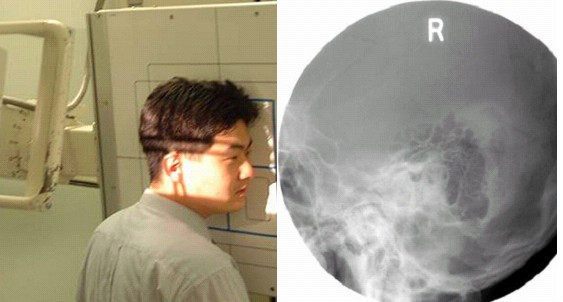 CE4RT - X-ray Positioning of the Mastoid Process for Radiologic Techs