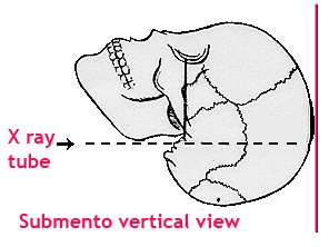 CE4RT - X-ray Positioning of the Mastoid Process for Radiologic Techs