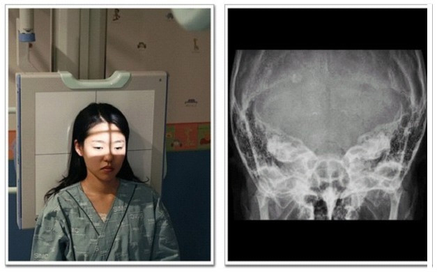 CE4RT - X-ray Positioning of the Mastoid Process for Radiologic Techs