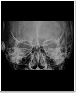 CE4RT - X-ray Positioning of the Mastoid Process for Radiologic Techs
