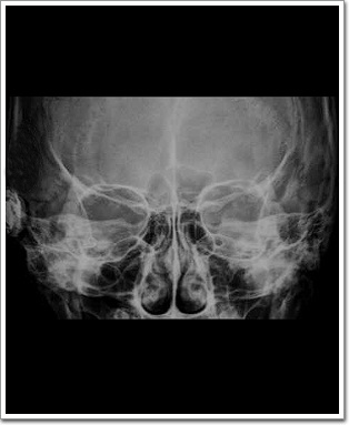 CE4RT - X-ray Positioning of the Mastoid Process for Radiologic Techs
