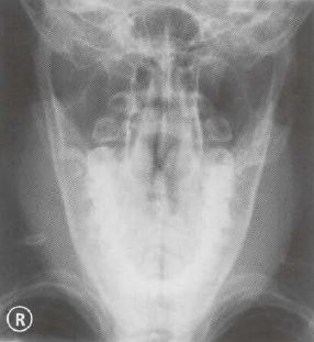 CE4RT - Radiographic Positioning Face and Mandible for X-ray Techs
