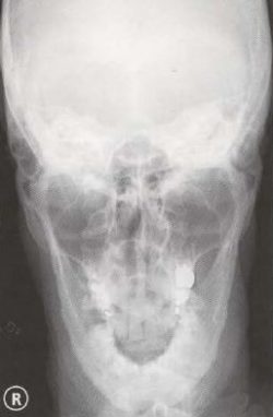 CE4RT - Radiographic Positioning Face and Mandible for X-ray Techs