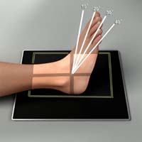 Calcaneus X-Ray Positioning: Complete Guide for Heel & Ankle Imaging ...
