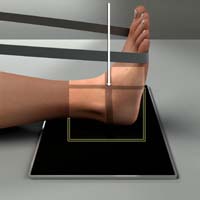 Calcaneus X-Ray Positioning: Complete Guide for Heel & Ankle Imaging ...