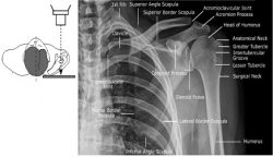 CE4RT - Radiographic Positioning of the Shoulder for X-ray Techs