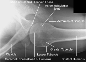 CE4RT - Radiographic Positioning of the Shoulder for X-ray Techs