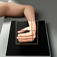 CE4RT - Radiographic Positioning of the Hand and Fingers for X-ray Techs