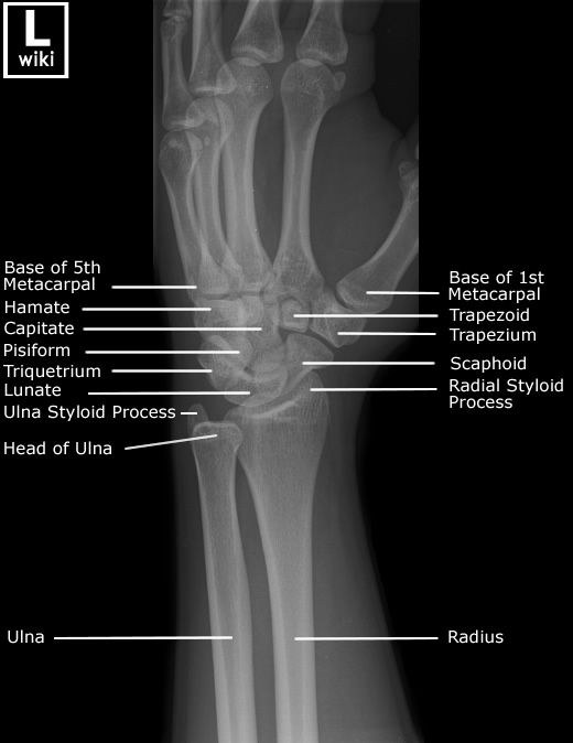 CE4RT - Radiographic Positioning of the Wrist for X-ray Technologists