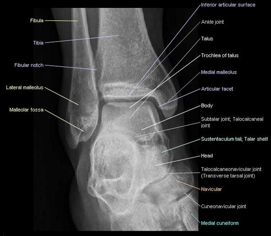 CE4RT - Radiographic Positioning of the Heel and Ankle for X-ray Techs