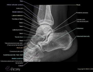 Calcaneus X-Ray Positioning: Complete Guide for Heel & Ankle Imaging ...
