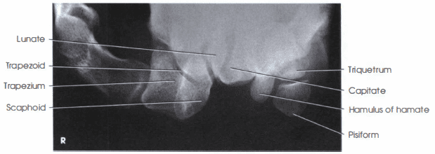 CE4RT - Radiographic Positioning of the Wrist for X-ray Technologists