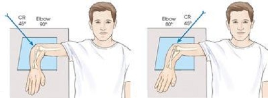 CE4RT - Radiographic Positioning of the Elbow for X-ray Technicians