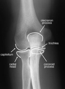 CE4RT - Radiographic Positioning of the Elbow for X-ray Technicians