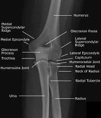 CE4RT - Radiographic Positioning of the Elbow for X-ray Technicians