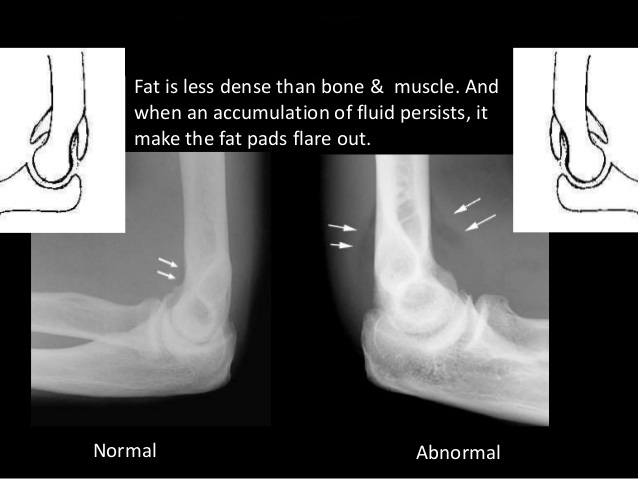 CE4RT - Radiographic Positioning of the Elbow for X-ray Technicians