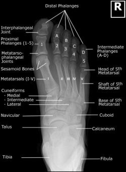 CE4RT - Radiographic Positioning of the Distal Feet for X-ray Techs