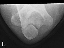 CE4RT - Radiographic Positioning of the Elbow for X-ray Technicians