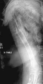 CE4RT - Radiographic Positioning of the Shoulder for X-ray Techs
