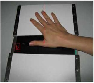 CE4RT - Radiographic Positioning of the Hand and Fingers for X-ray Techs