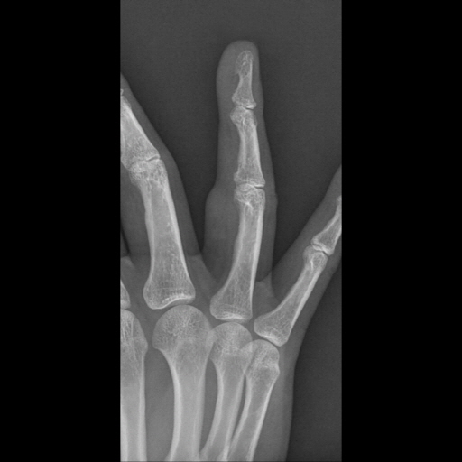 CE4RT - Radiographic Positioning of the Hand and Fingers for X-ray Techs