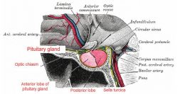 CE4RT - Radiography of the Sella Turcica for X-ray Techs
