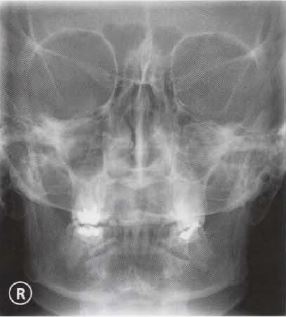 CE4RT - Radiographic Positioning Face and Mandible for X-ray Techs