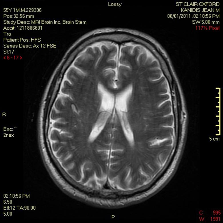 basilar skull fractures Archives - CE4RT